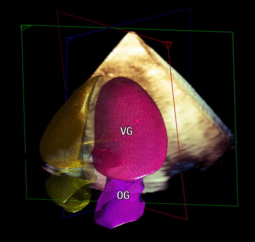 Echovision: What is it? - Echovision
