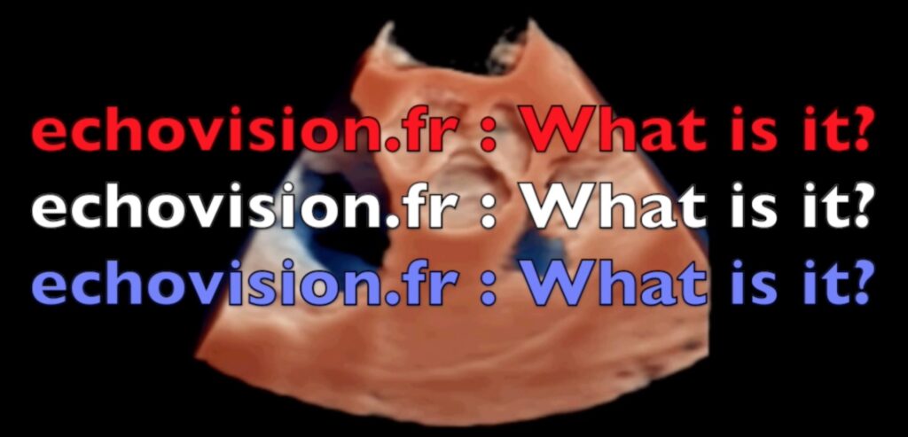 CT SCAN Archives - Echovision